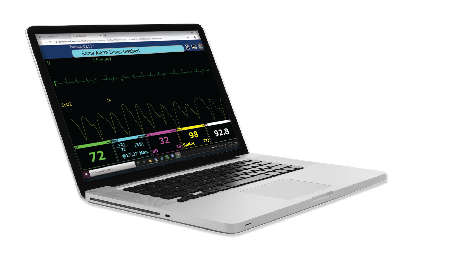 RescueNet Live Telehealth Software | ZOLL Medical