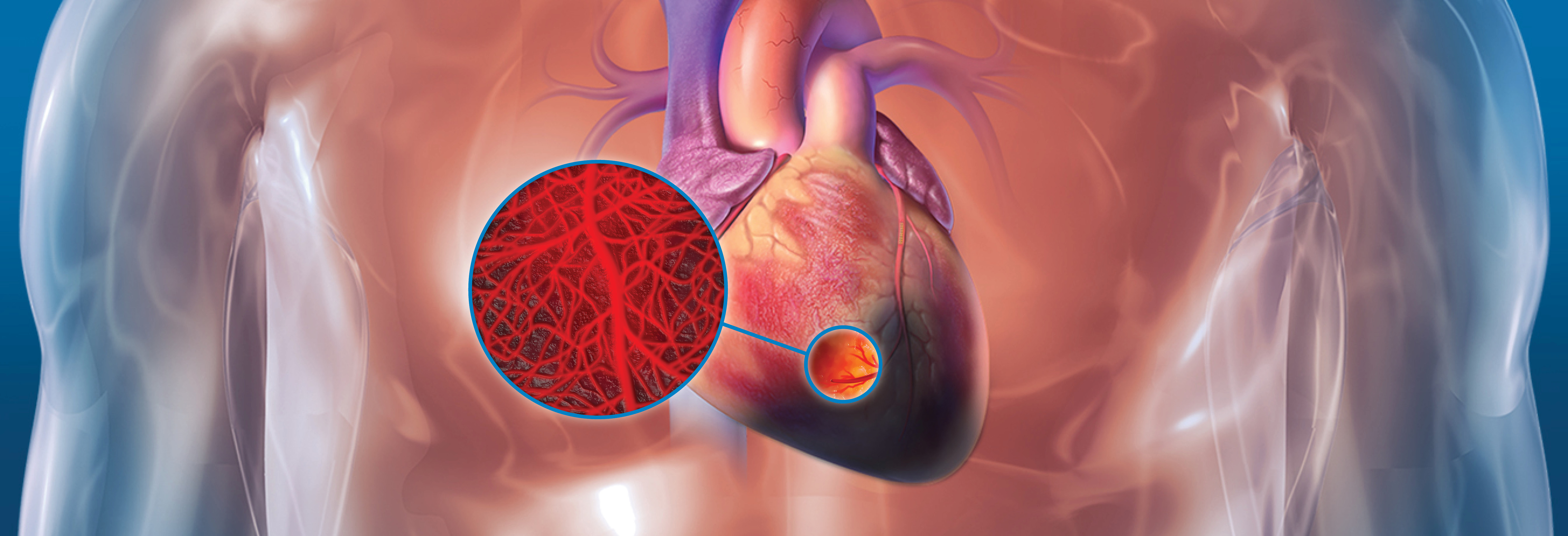 TherOx SSO2 System: Console, Cartridge, and SSO2 Catheter - ZOLL Medical