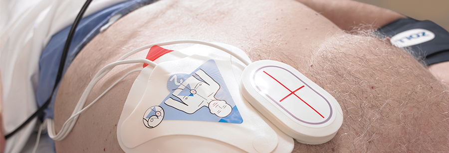 Defibrillator Pad Placement - ZOLL Medical